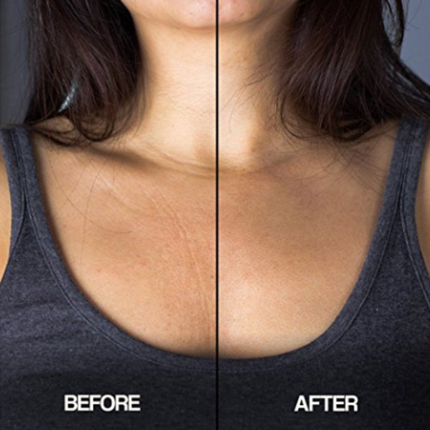 Reusable Anti Wrinkle Chest Pad